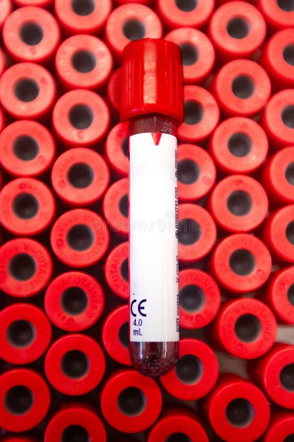 Vacuum Tubes for Collection and Blood Samples in Medical Laboratory ...