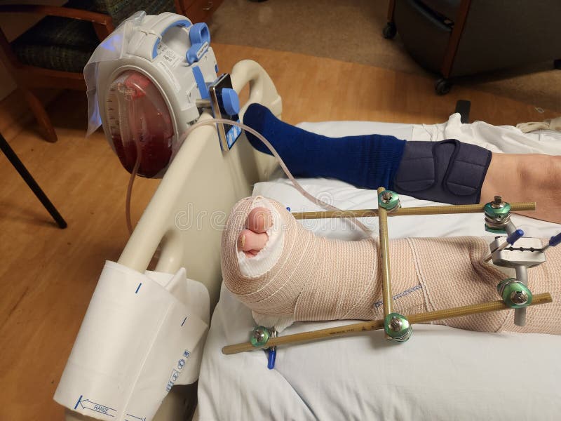 211 Leg Wound Dressing Stock Photos - Free & Royalty-Free Stock Photos ...