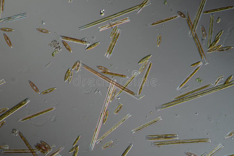 Diatomeas del mar foto de archivo. Imagen de redondo - 194437848