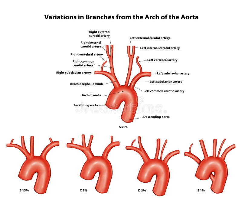 Variations in Branches from the Arch of the Aorta Stock Illustration ...