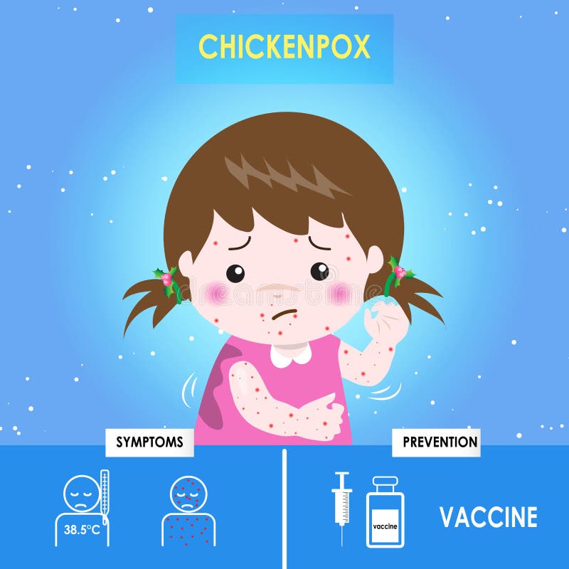 Chickenpox Infographic Stock Illustrations – 46 Chickenpox Infographic ...