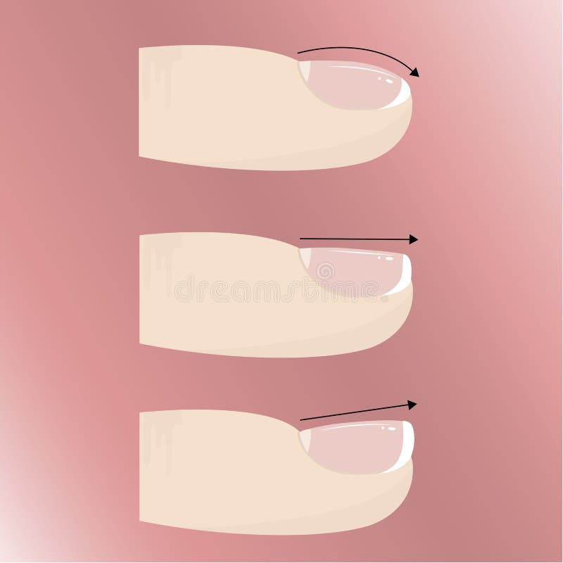 Varieties of Different Forms and Types of Nail Plate. Manicure and Nail ...