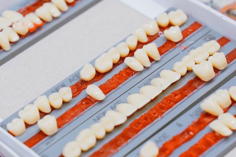 Variety of Dentures Displayed in Dental Laboratory for Various Patient ...