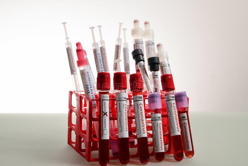 Various Test Tubes, Pipettes and Coronavirus Tests. Microbiology ...