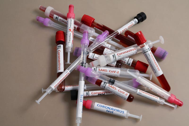 Various Test Tubes, Pipettes and Coronavirus Tests. Microbiology ...