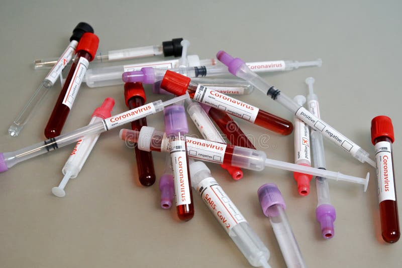 Various Test Tubes, Pipettes and Coronavirus Tests. Microbiology ...