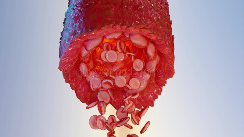 Vasoconstriction and Vasodilation Blood Pressure, Dilated Blood Vessels ...