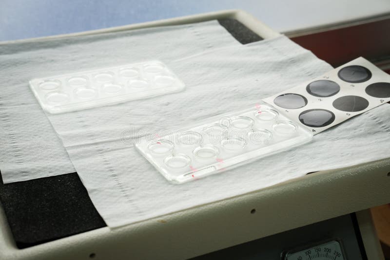 VDRL stock image. Image of rapid, blood, serum, medical - 77872967