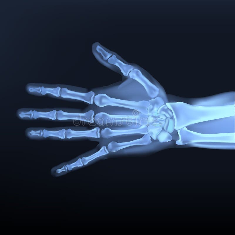 Vecteur Du Rayon X De Main D'a Illustration Stock - Illustration du ...