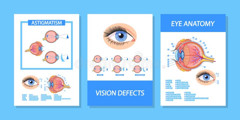 Vector Banners with Detailed Infographic Explaining Eye Anatomy, Vision ...