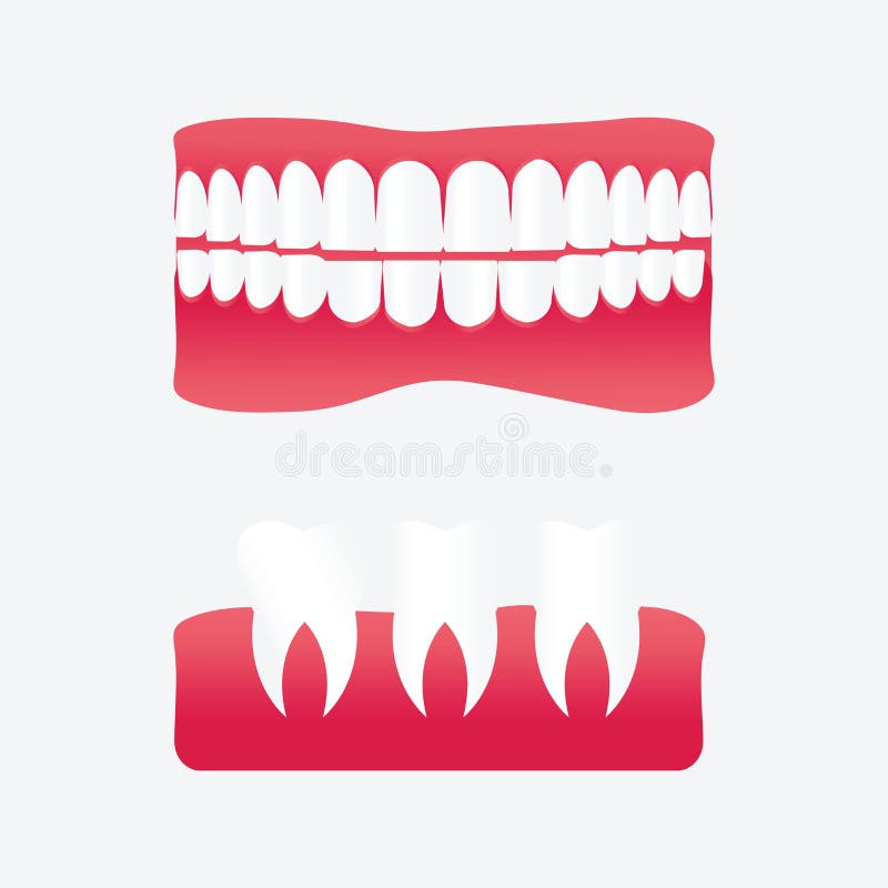 Vector cartoon false teeth stock vector. Illustration of medical - 73015267
