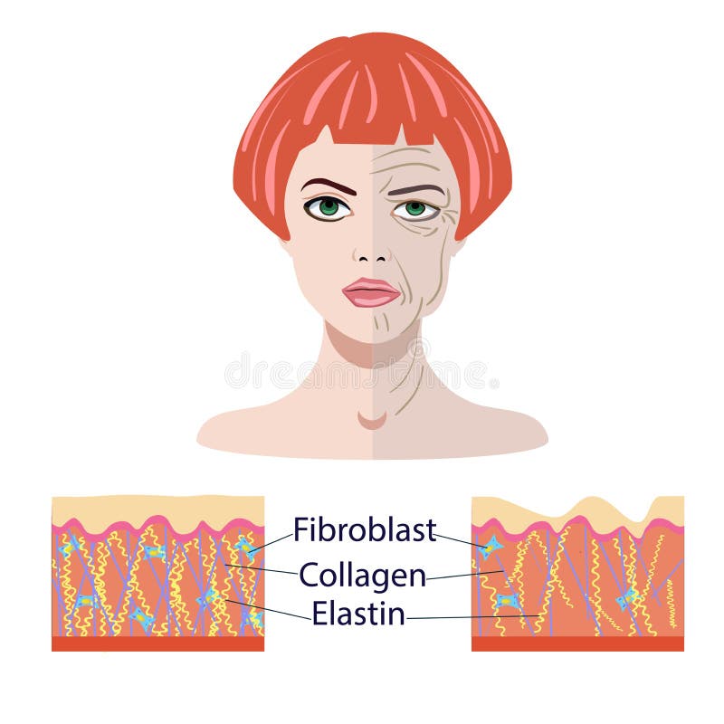 Vector Face and Two Types of Skin - Aged and Young for Medical and ... Vector Face and Two Types of Skin - Aged and Young for Medical and ...