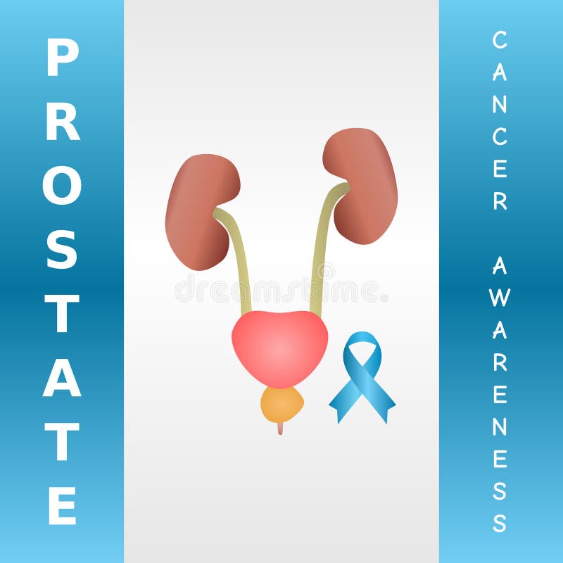 Vector Graphic of Prostate Cancer Awareness Good for Prostate Cancer ...