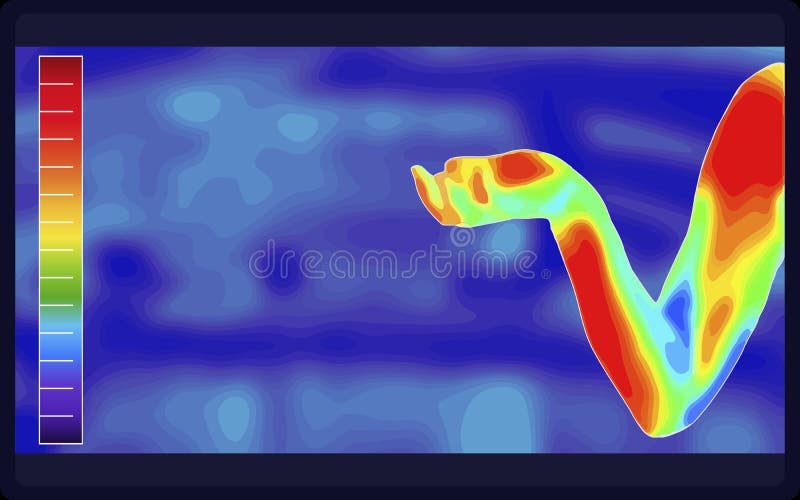 Illustration Vector Graphic of Thermal Image Scanning Two Human Hands ...