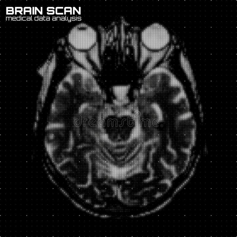 Vector Grayscale Abstract Brain Tomography Analysis Illustration ...