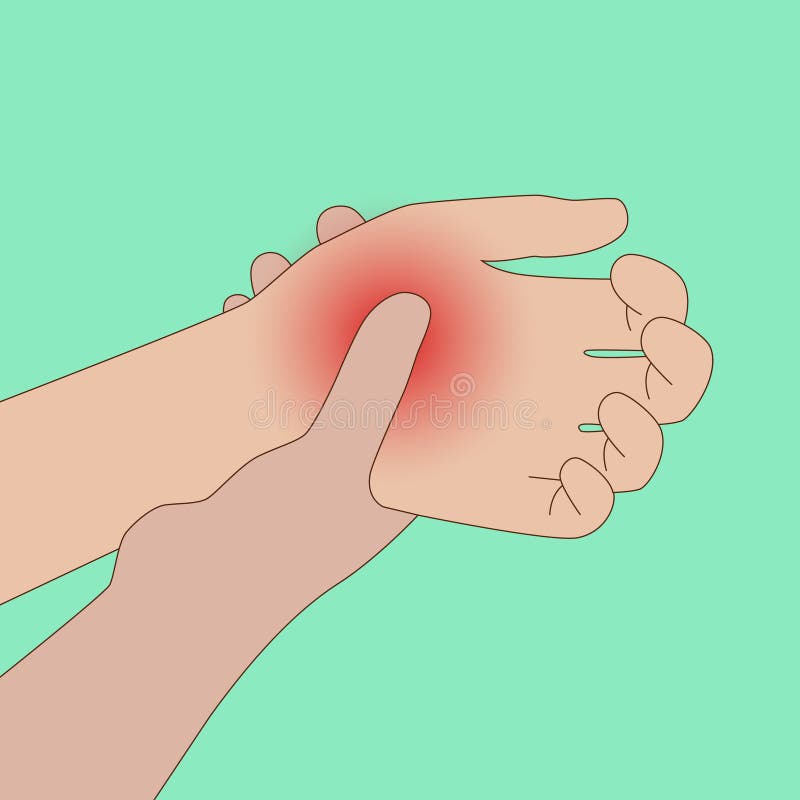 First Aid Swelling Stock Illustrations – 53 First Aid Swelling Stock ...