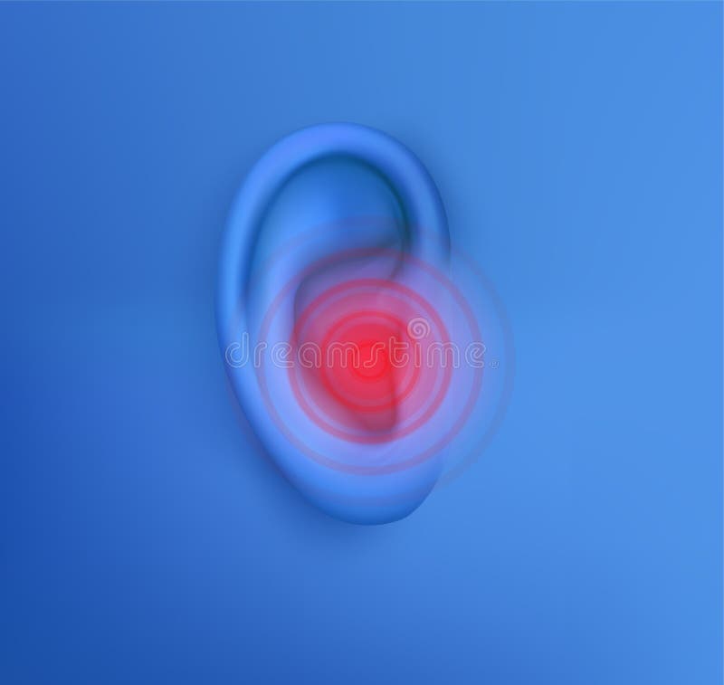 Tympanitis Stock Illustrations – 19 Tympanitis Stock Illustrations ...