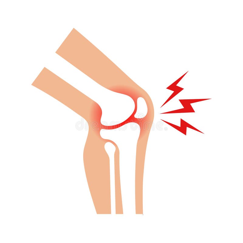 Vector Illstration of Joint Pain Icon. Flat Design. Isolated. Stock ...