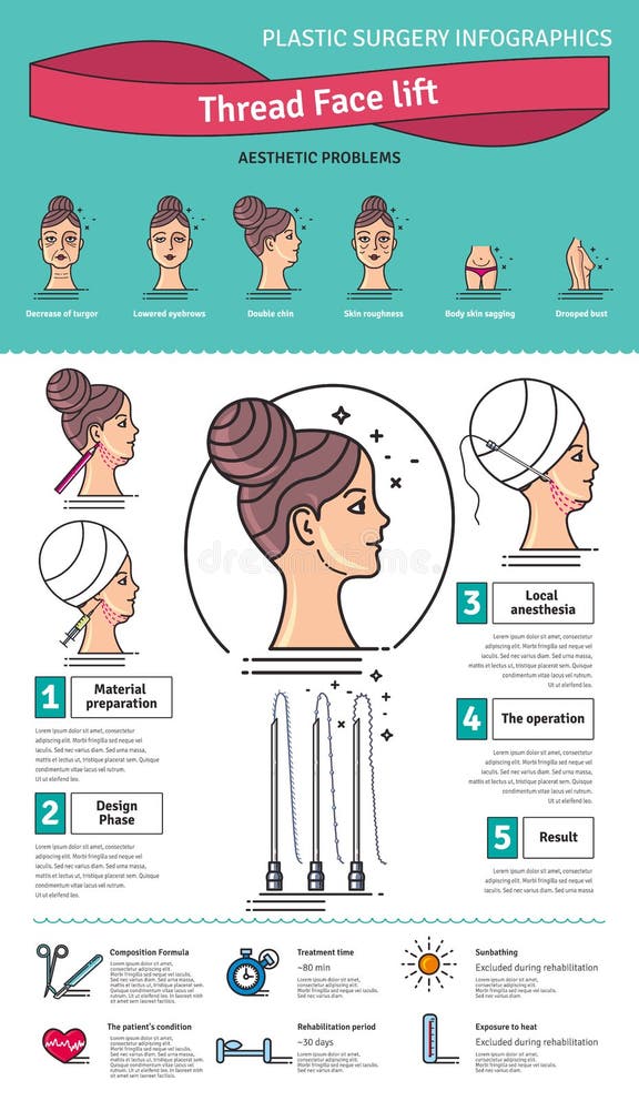 Vector Illustrated Set with Face Lifting Surgery by Threads Stock ...