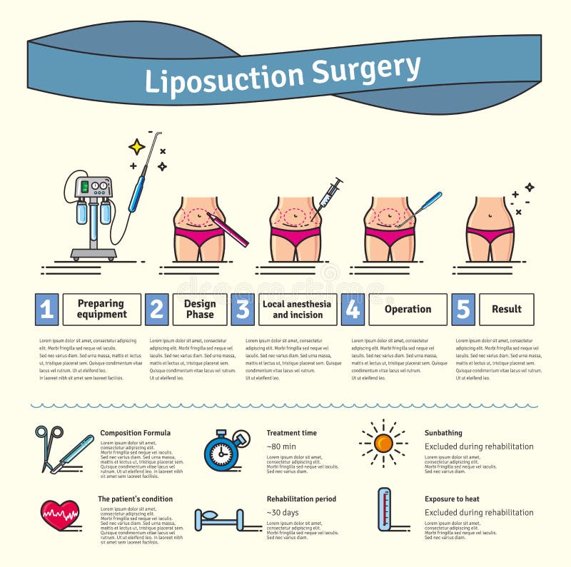 Vector Illustrated Set with Liposuction Surgery Stock Illustration ...
