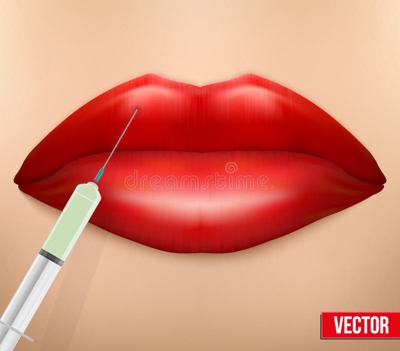 Vector Illustration of a Botox Injection. Stock Vector - Illustration ...
