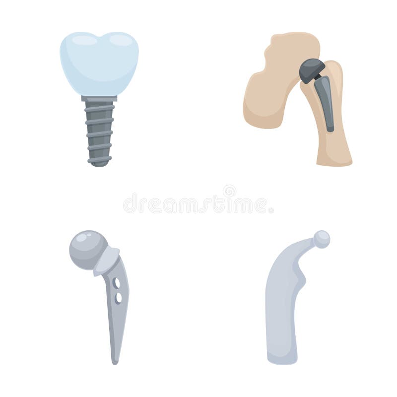 Orthopedic and Dental Implants Set Stock Vector - Illustration of oral ...