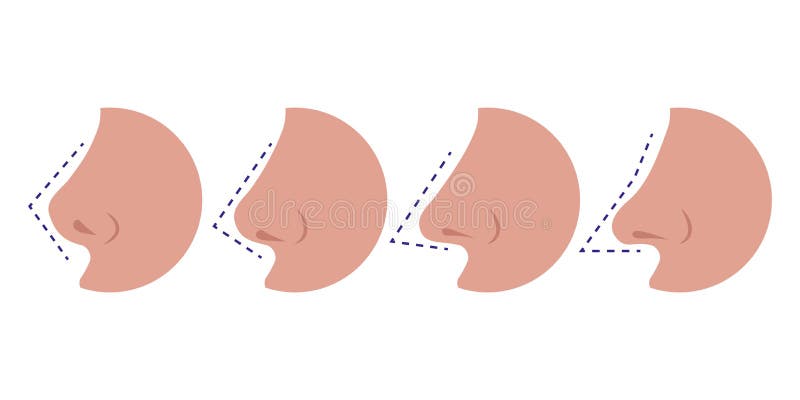Vector Illustration Different Types Female Noses Stock Vector ...