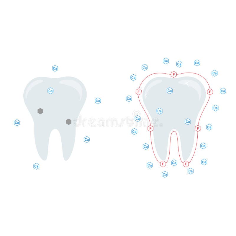 Vector Illustration. the Effect of Calcium and Fluoride on Teeth Stock ...