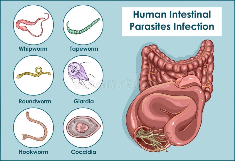 Vector Illustration of a Human Intestinal Parasites Stock Vector ...