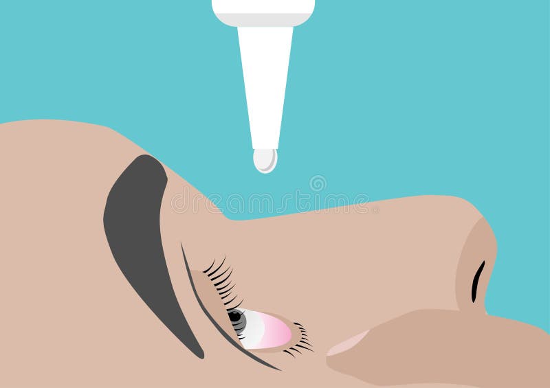 Vector Illustration of Man Applying Eyedropper into the Eye. Stock ...
