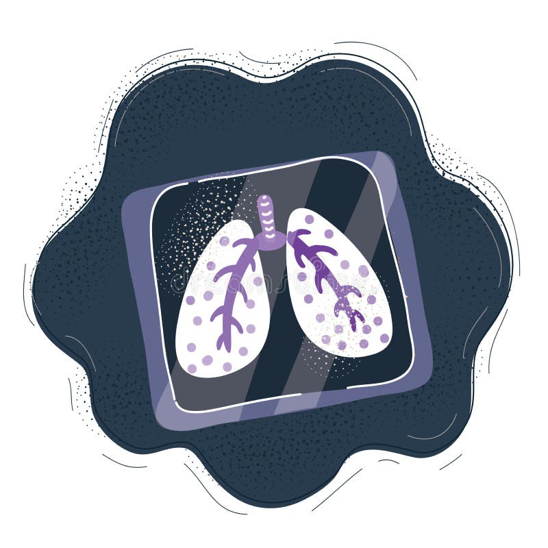 Vector Illustration of X-Ray Image of Human Healthy Chest on Dark ...