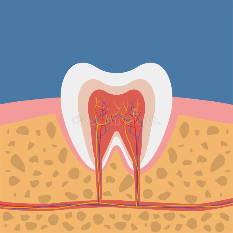 Vector Illustration: the Structure of Tooth Stock Illustration ...