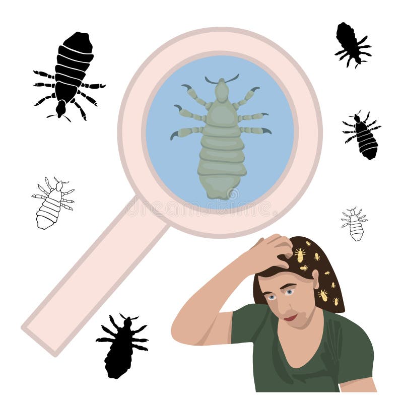 Vector Isolated Illustration of Head Lice Check. Lice Detection Stock ...