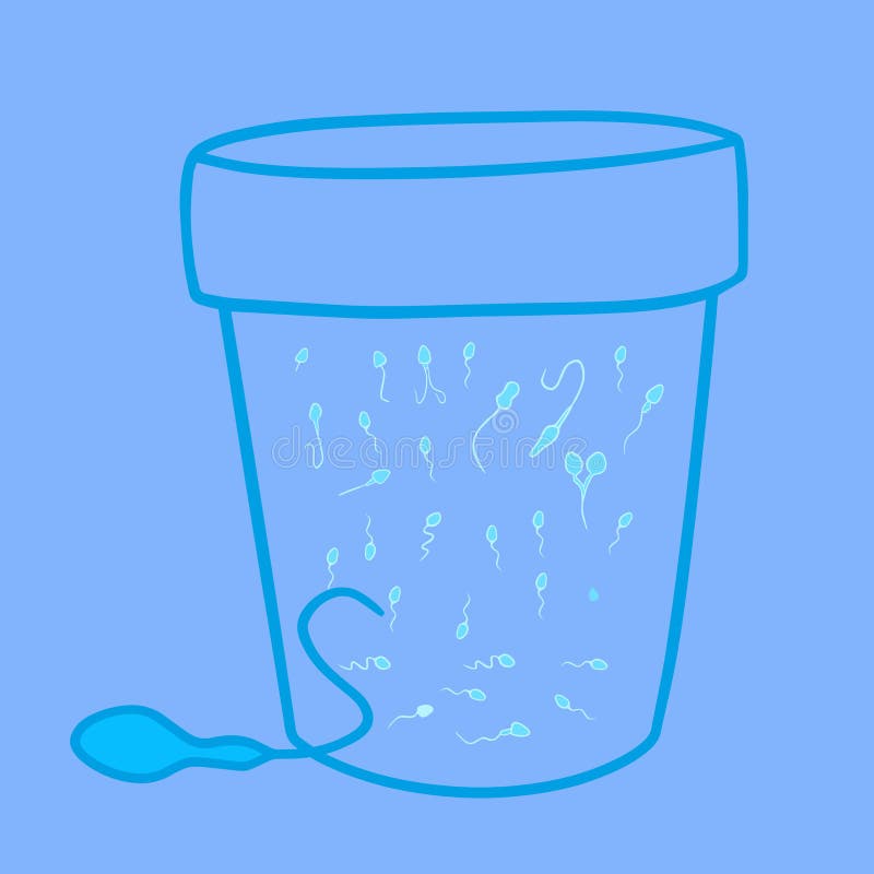 Vector Isolated Illustration of Sperm Defects. Spermogram Stock Vector ...