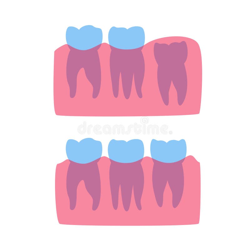 Vector Isolated Illustration Of Tooth Stock Vector Illustration Of