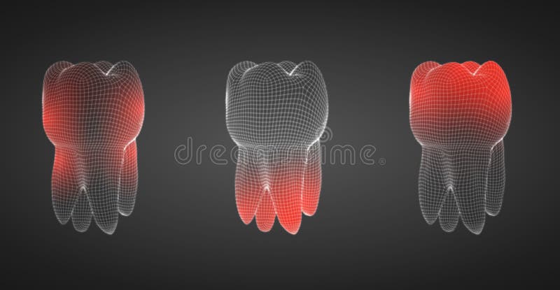 Vector Set of 3d Teeth on a Dark Background. Toothache Stock Vector ...