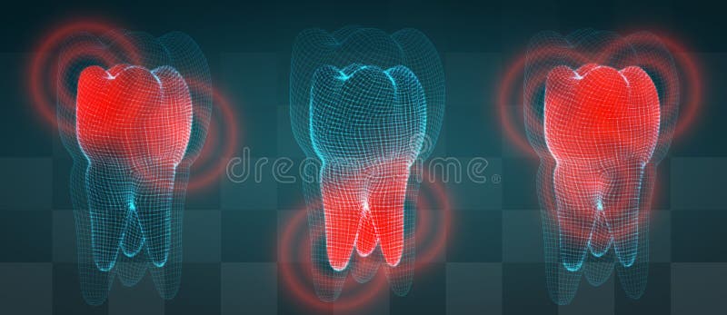 Vector Set of 3d Teeth on a Dark Background. Toothache Stock Vector ...