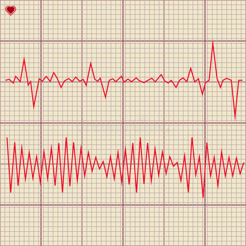 Death Heart Beat Stop Stock Illustrations – 42 Death Heart Beat Stop ...