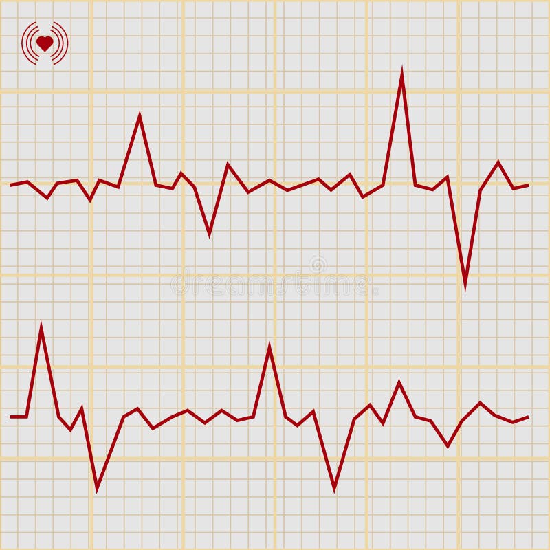 Vector Set of Various Cardiogram Design Elements. Stock Vector ...