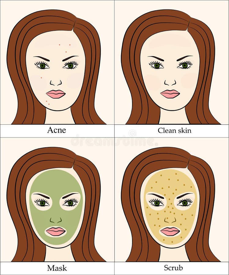 Skin Rashes Stock Illustrations – 246 Skin Rashes Stock Illustrations ...