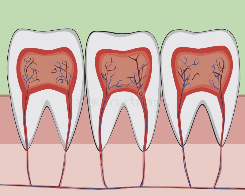 A Molar Structure with Enamel and Nerves on the Gum and Jaw,a Flat ...