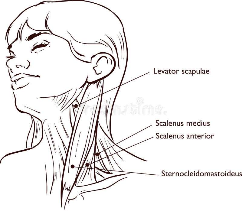 Vectorafbeelding Van Nekspieren Anatomie Vector Illustratie ...