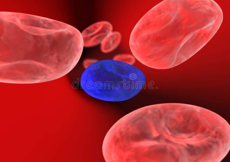 Fungemia, Systemic Fungal Infection, Candida Fungi in Blood Stock ...