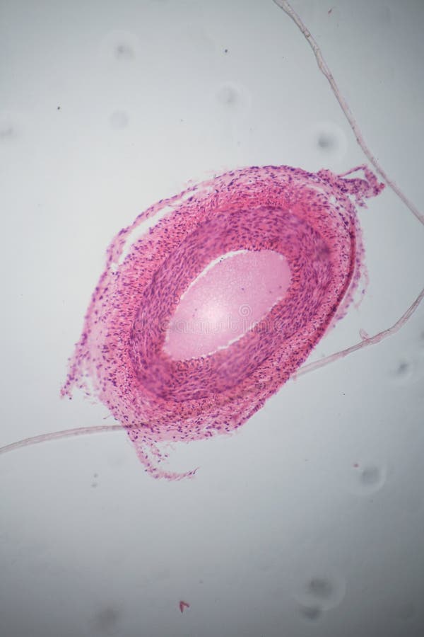 Vein Section stock image. Image of human, endothelium - 84221685