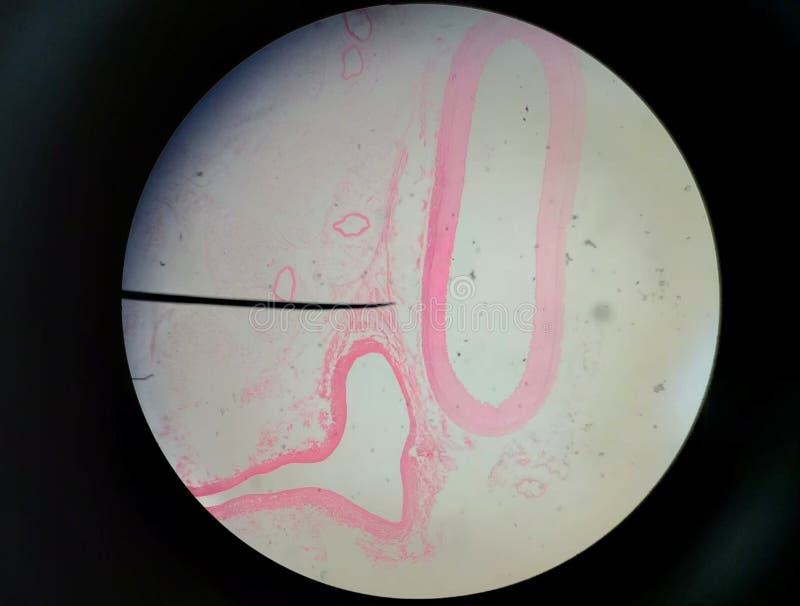 Veins and Arteries that Shines through the Microscope Stock Photo ...