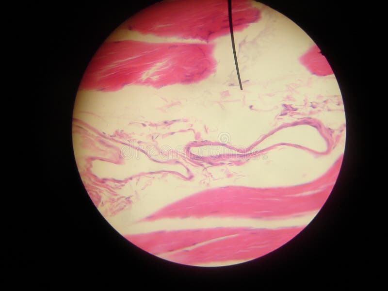 Veins at microscope stock image. Image of microscopia - 12305295