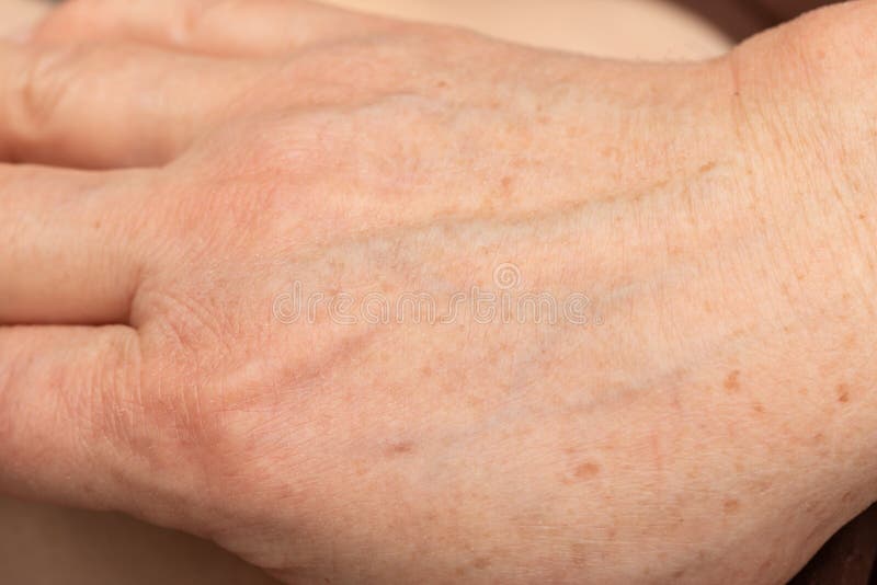 Venas En La Piel De Las Manos Foto de archivo - Imagen de flujo, pelos ...