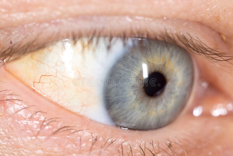 Venas Rojas En El Ojo De Un Niño, Macro Imagen de archivo - Imagen de ...