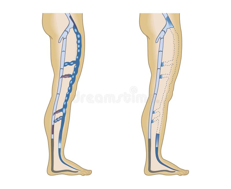 Vene Della Gamba Dell'illustrazione Di Vettore Illustrazione Vettoriale ...