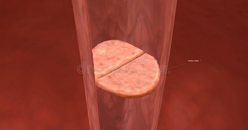 The Venous Circulation Consists of an Interconnected System of Veins ...